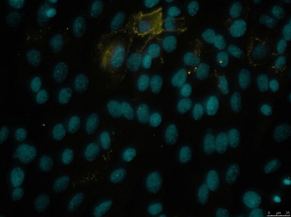 PyMT-1099 Mouse Mammary Tumor EMT Model Cell Line | SCC422